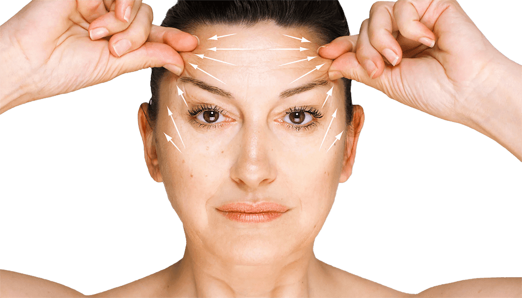 Lifting de cejas | Dr. Ignacio Ortega | Cirujano Plástico